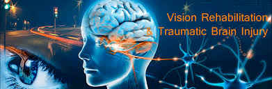 Vision Therapy | HOPE TBI