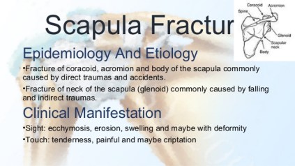 Shoulder Injuries From Trauma – Scapula Nonunion | HOPE TBI